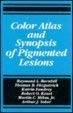 Color Atlas and Synopsis of Pigmented Lesions book by Raymond L ...