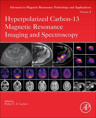 Hyperpolarized Carbon-13 Magnetic Resonance Imaging and Spectroscopy ...