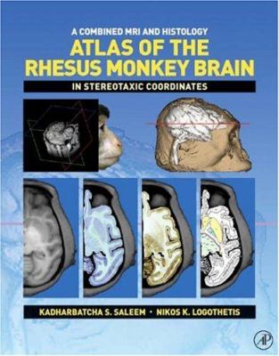 A Combined MRI and Histology Atlas of the Rhesus Monkey Brain in ...