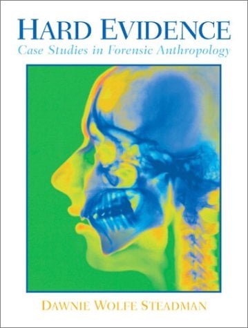 Hard Evidence : Case Studies in Forensic Anthropology used book by ...