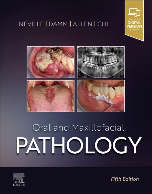 Oral and Maxillofacial Pathology book by Brad W. Neville: 9780323789813