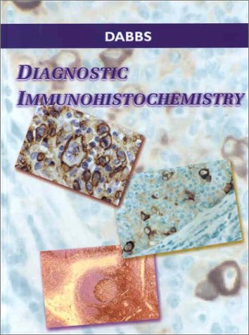 Diagnostic Immunohistochemistry used book by David J. Dabbs: 9780443065668