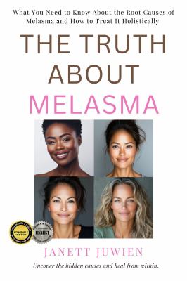 The Truth about Melasma : What You Need to Know about the Root Causes ...