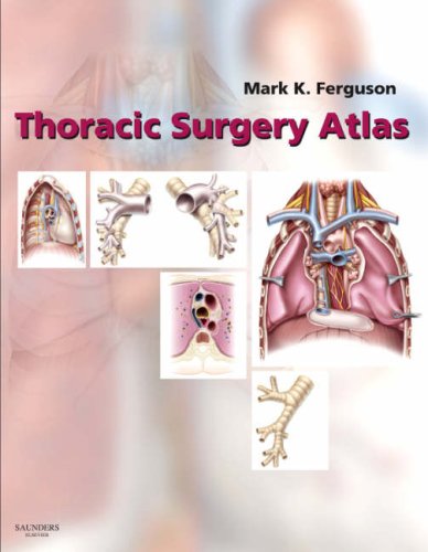 Thoracic Surgery Atlas used book by Mark K. Ferguson: 9780721603254