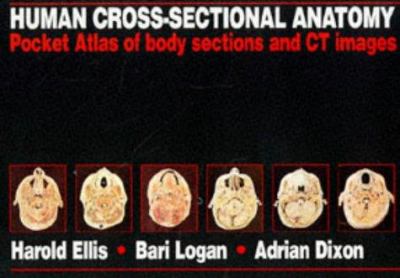 Human Cross-Sectional Anatomy : Pocket Atlas of Body Sections and CT ...
