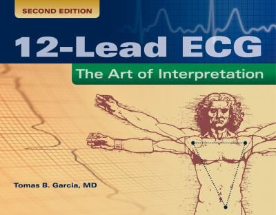 12-Lead ECG: the Art of Interpretation used book by Tomas B. Garcia ...