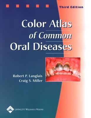 Color Atlas of Common Oral Diseases used book by Robert P. Langlais ...