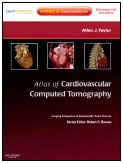 Atlas of Cardiovascular Computed Tomography book by Allen J. Taylor ...