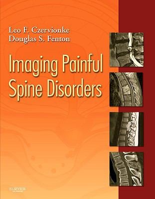 Imaging Painful Spine Disorders book by Leo F. Czervionke, Douglas S ...