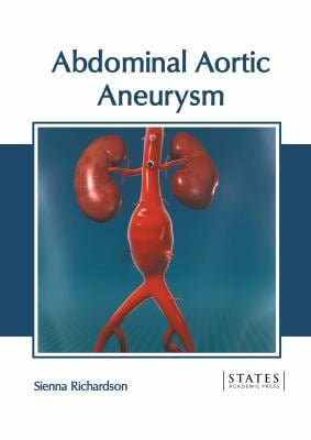 Abdominal Aortic Aneurysm book by Sienna Richardson: 9781639890118