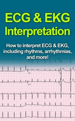 ECG and EKG Interpretation : How to Interpret ECG and EKG, Including ...