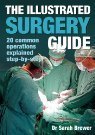 The Illustrated Surgery Guide : 20 Common Operations Explained Step by ...