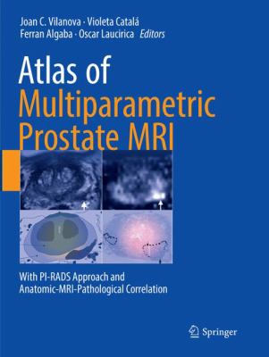 Atlas of Multiparametric Prostate MRI : With PI-RADS Approach and ...