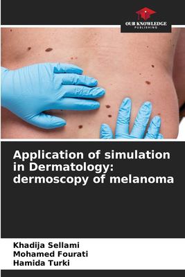 Application of simulation in Dermatology: dermoscopy of melanoma book ...