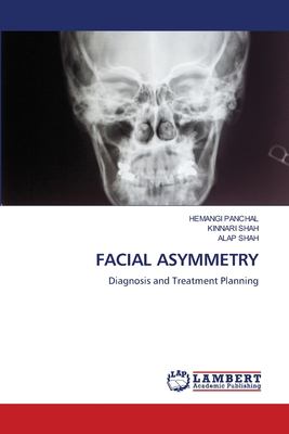 FACIAL ASYMMETRY: Diagnosis and Treatment Planning book: 9786206148890