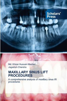 MAXILLARY SINUS LIFT PROCEDURES: A comprehensive analysis of maxillary ...