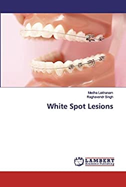 White Spot Lesions book: 9786200487568