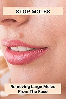 Stop Moles: Removing Large Moles From The Face: Surefire Way To Get Rid ...