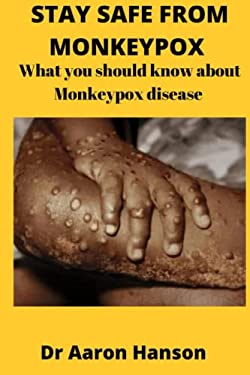 STAY SAFE FROM MONKEYPOX: What You Should Know About Monkeypox Disease ...