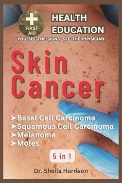 Skin Cancer: Basal Cell Carcinoma, Squamous Cell Carcinoma, Melanoma Skin Cancer, Mole: Types ...