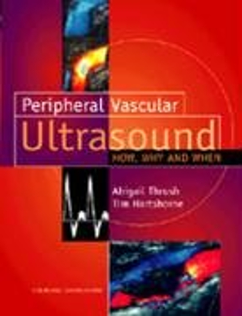 PERIPHERAL VASCULAR ULTRASOUND : How, Why and When Paperback £16.43 ...